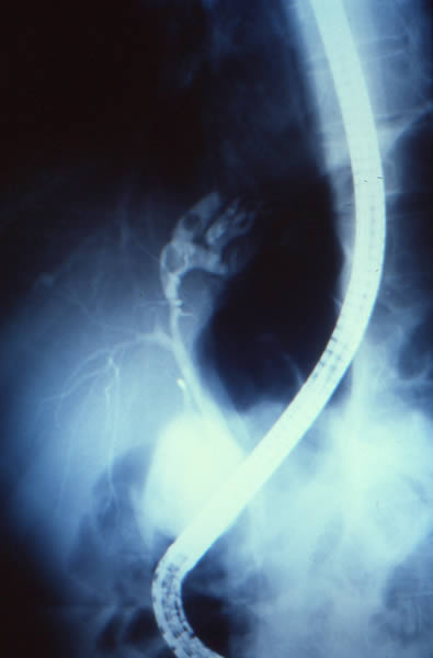 Laparoscopía y Endoscopía El Salvador ::: http ...