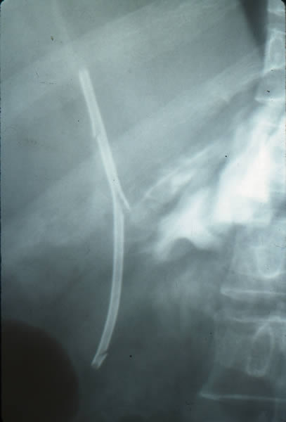 Laparoscopía y Endoscopía El Salvador ::: http ...